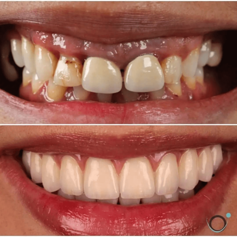 Reabilitação Oral em São Paulo: Restaure seu Sorriso na Clínica ...