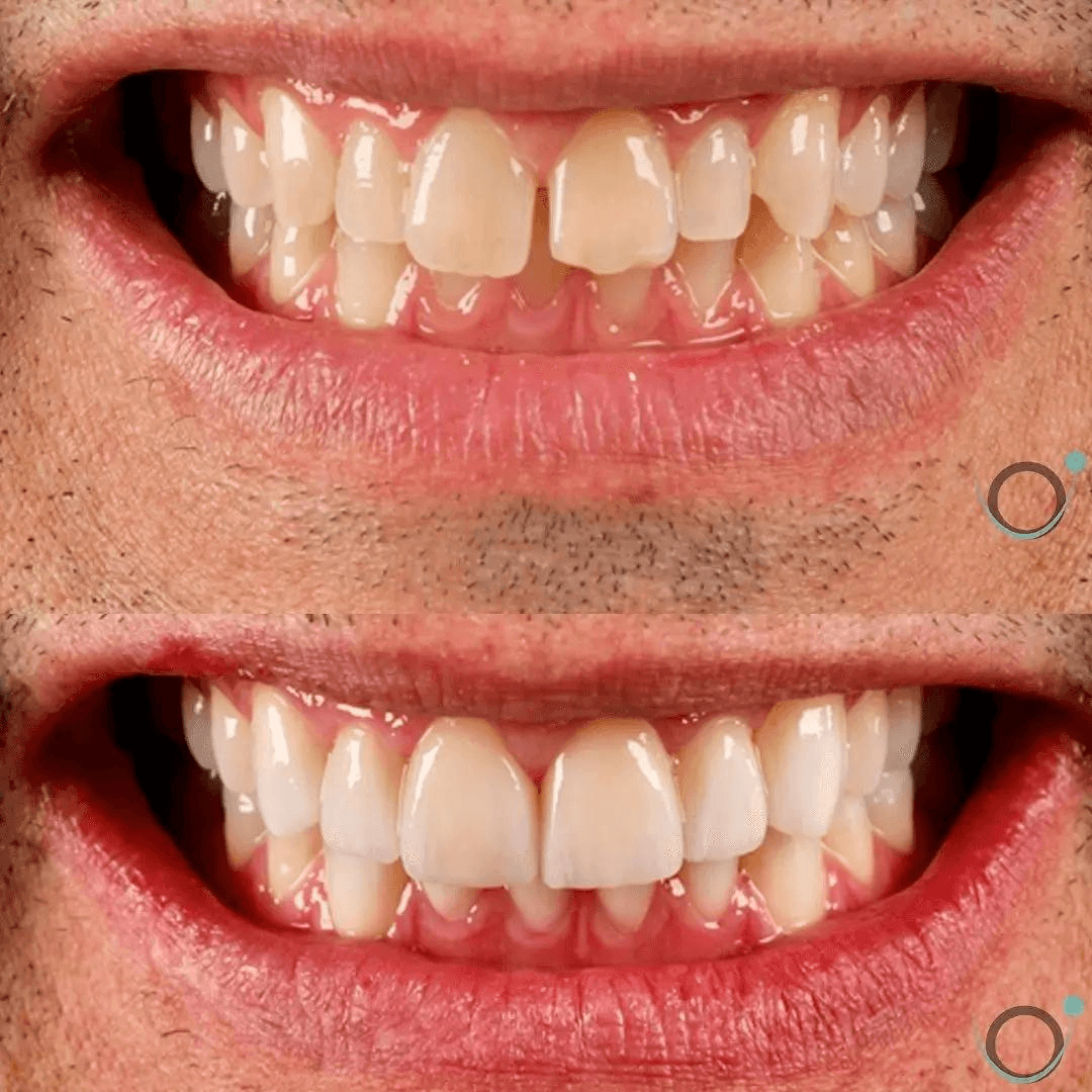 Reabilitação Oral em São Paulo: Restaure seu Sorriso na Clínica ...